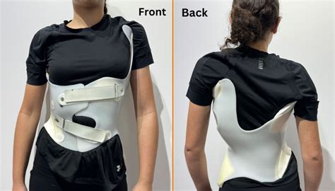 How Effective Are Back Braces