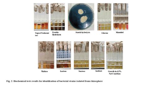 Isolation And Identification Of Bacteriocin Producing Microbial Strains