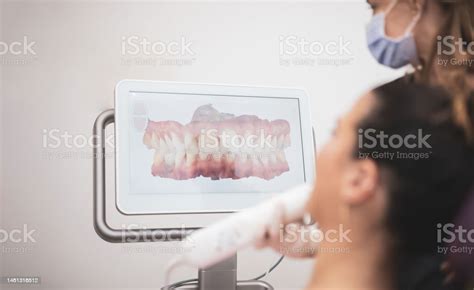 현대 클리닉에서 3d 치과 스캐너 3d 턱 스캐너 화면으로 환자의 치아를 스캔하는 여성 치과 의사 2명에 대한 스톡 사진 및 기타 이미지 Istock