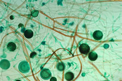 Rhizopus Mold On Bread