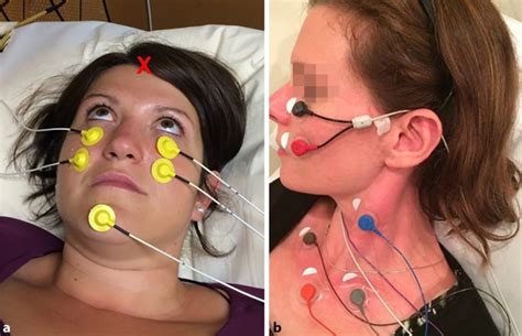 Vestibular Evoked Myogenic Potentials Vemp Testing An In Depth Look