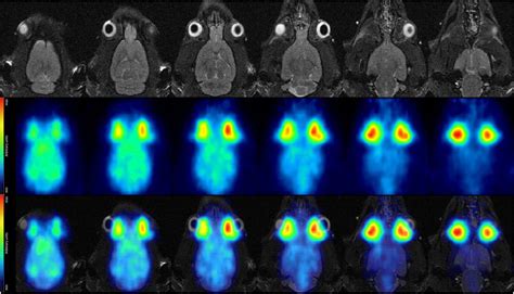 Recent Advances In Positron Emission Tomographymagnetic Resonance Imaging Technology Magnetic