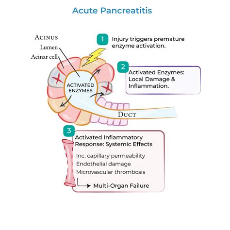 Clinical Pathology Glossary Pancreatitis Ditki Medical And Biological Sciences