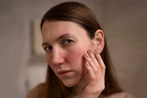 من الإكزيما إلى العد الوردي 6 أسباب وراء البقع الحمراء على الجلد