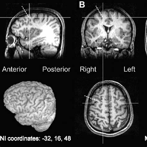 The Targeted Location Over The Frontal Eye Field In The Left A Or Download Scientific Diagram