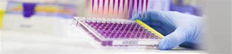 End To End Development Of Laboratory Diagnostics Software Case Study