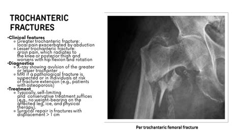 Proximal Femur Fracture Classification Ppt Pptx