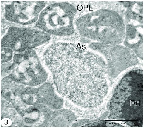 From Retina Group I Tem Showing An Astrocyte As In The Outer Download Scientific Diagram
