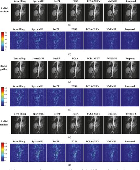 Figure 1 From Compressed Sensing Mri Reconstruction With Multiple Sparsity Constraints On Radial