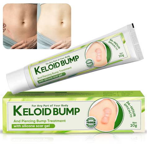 Scar Cream Gel 20g Effective Keloid And Surgical Scar Removal