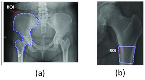 examples of roi selection for attribute index calculation at a