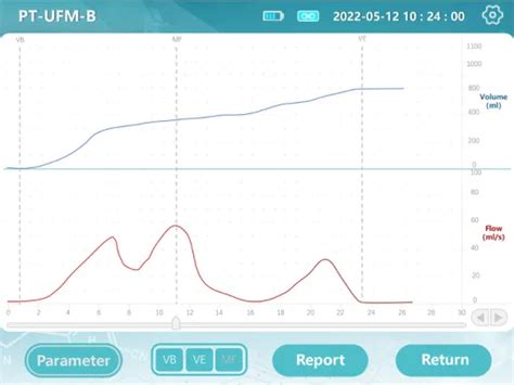 Urology Instruments Uroflow Pc Serie1100ml Peak Flow Rate Uroflowmetry For Bladder Meter