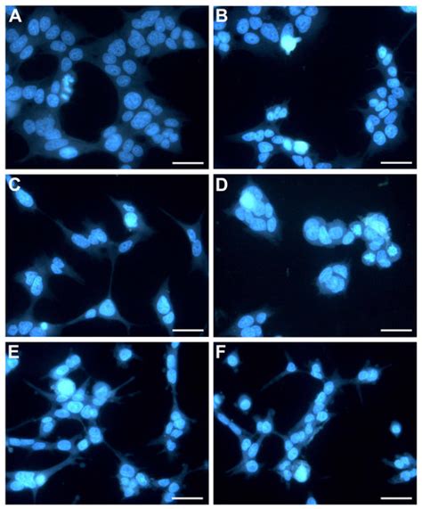 Can Macroalgae Provide Promising Anti Tumoral Compounds A Closer Look