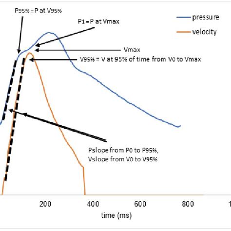 The Aortic Flow Velocity And Pressure Waveform Schematic Download