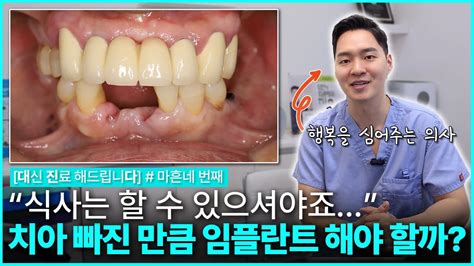 [대진다] 음식을 씹는 행복이 얼마 만인지 │당일 임플란트 당일 임시치아 임플란트 뼈이식 앞니 임플란트 어금니 임플란트│ 마흔네 번째 Youtube