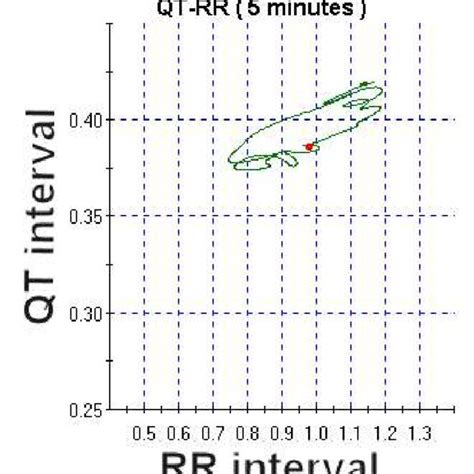 Qt Interval Hysteresis Versus Rr Dynamic Relationship Download Scientific Diagram