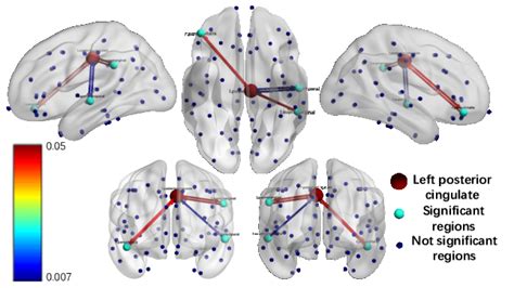 The Most Prominent Brain Connections And Corresponding Brain Regions Download Scientific