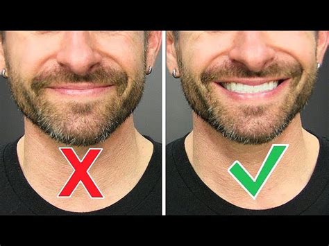 How To Get The Perfect Smile