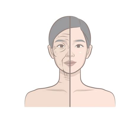 Asian Woman Before After Sagging Skin Over 19 Royalty Free Licensable