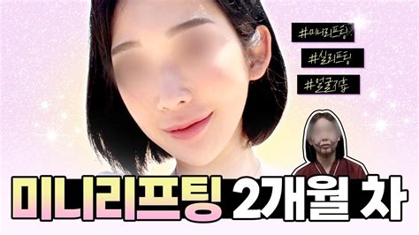 미니 리프팅 실리프팅 얼굴 지방흡입 제가 받아봤습니다 L 리프팅 2개월 차 브이로그 L 인싸언니 Youtube