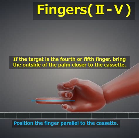 Finger Lateral View｜tools For Radtech