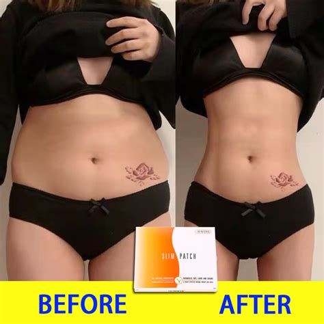 【ready Stock】slimming Patch Detox Slim Original Patch Lazy Fat Burning 10 Pieces Without