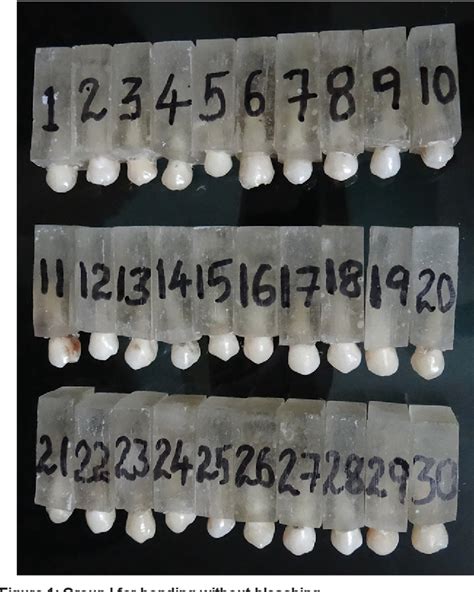 Figure 1 From Effects Of At Home And In Office Bleaching Agents On The Shear Bond Strength Of