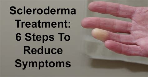 Scleroderma Treatment 6 Steps To Reduce Symptoms David Avocado Wolfe Scleroderma Treatment 6 Steps To Reduce Symptoms David Avocado Wolfe