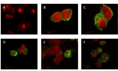 Hpv16 L1 Kinetic Expression By Confocal Laser Scanning Microscopy