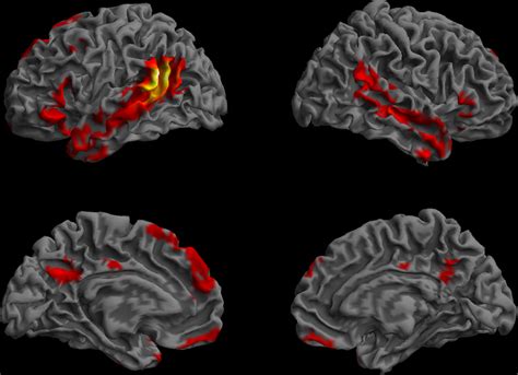 Resting State Functional Connectivity Pattern For The Posterior Download Scientific Diagram