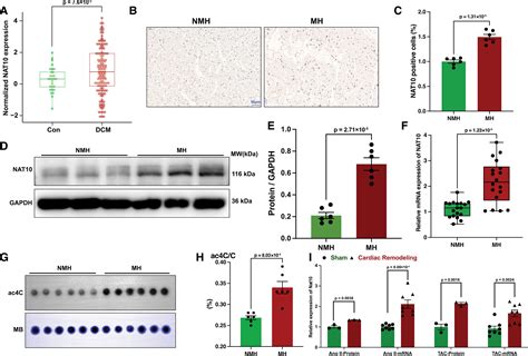Nat10 Is Involved In Cardiac Remodeling Through Ac4c Mediated Transcriptomic Regulation