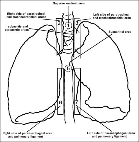 Mediastinal Lymph Node Levels