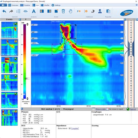 Solar™ Gi High Resolution Pharyngeal Manometry Laborie Eu
