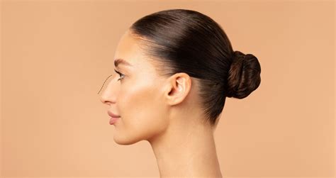 Is It Possible To Make The Nose Smaller Annakan Navaratnam