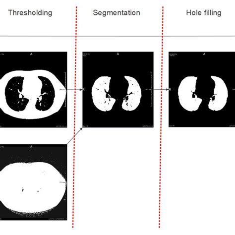 Overview Of The Lung Segmentation Download Scientific Diagram