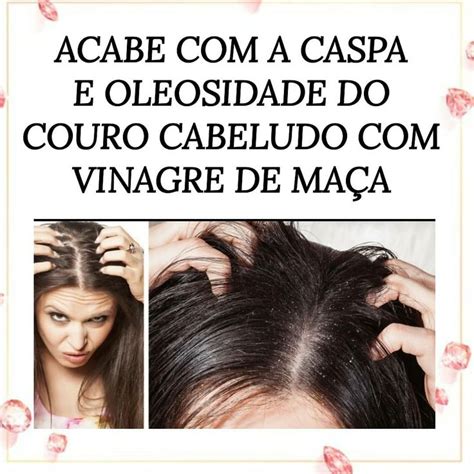 Dicas Para Cuidar Do Couro Cabeludo My Xxx Hot Girl