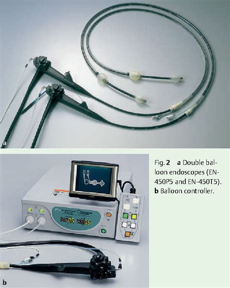 Figure 1 From Double Balloon Endoscopy Semantic Scholar