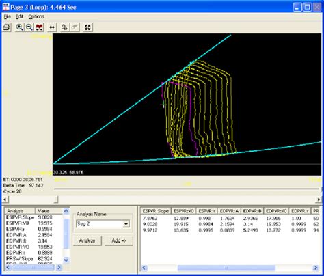 Pv Loop
