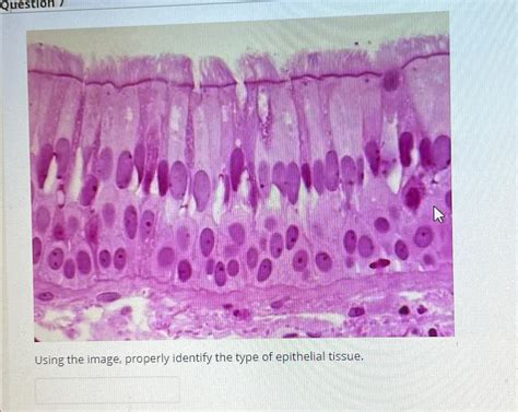 solved question using the image properly identify the type