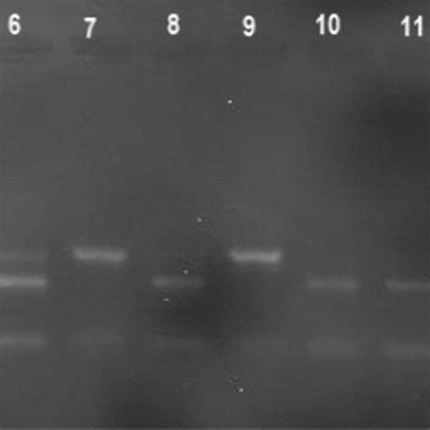 Agarose Gel Electrophoretic Graph Of The Nested Pcr Products In Head Download Scientific
