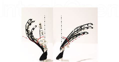 Tendon Excursion In The Fdp Of Each Finger Induced By Wrist Movement