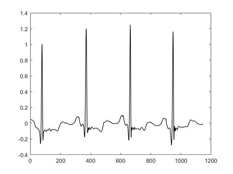 A Signal Before The Filtering B Signal After The Combination Of