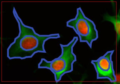 combining cellpose and stardist detections into cells image analysis