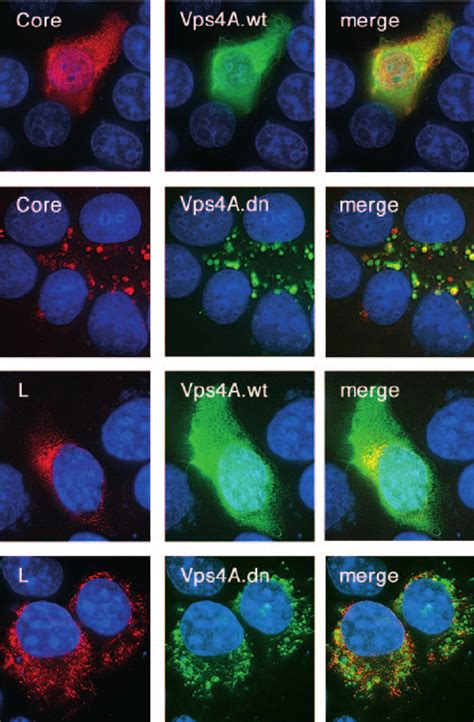 Dn Vps4a Redistributes Hbv Core And L To Aberrant Endosomal Class E