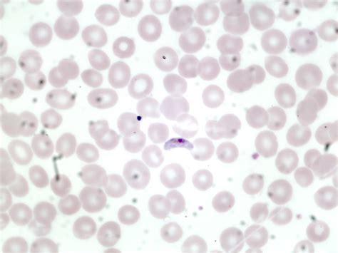 Noul Blog Trophozoites Schizonts And Gametocytes Plasmodium