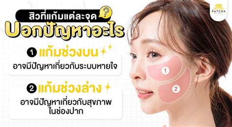 สิวขึ้นที่แก้มเกิดจากอะไร 7 วิธีรักษาสิวที่แก้ม