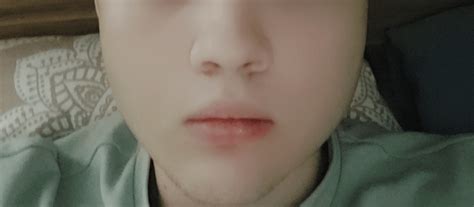 How Do I Fix My Lopsided Face R Orthotropics