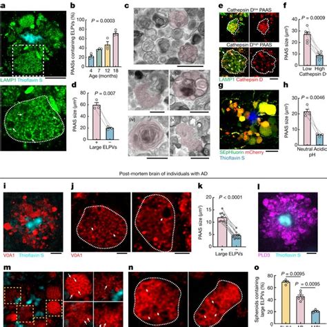 Plaque Associated Axonal Spheroids Block Ap Propagation And Disrupt