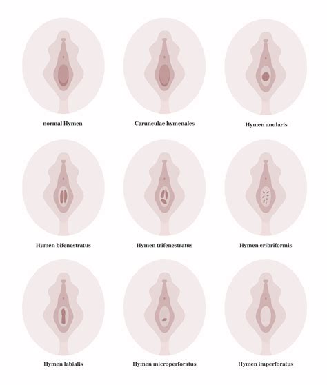 Hymen Breaking The Most Common Myths Healthnews