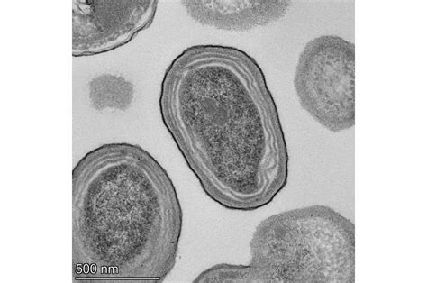 Ocean Warming Puts Vital Marine Microbe Prochlorococcus At Risk